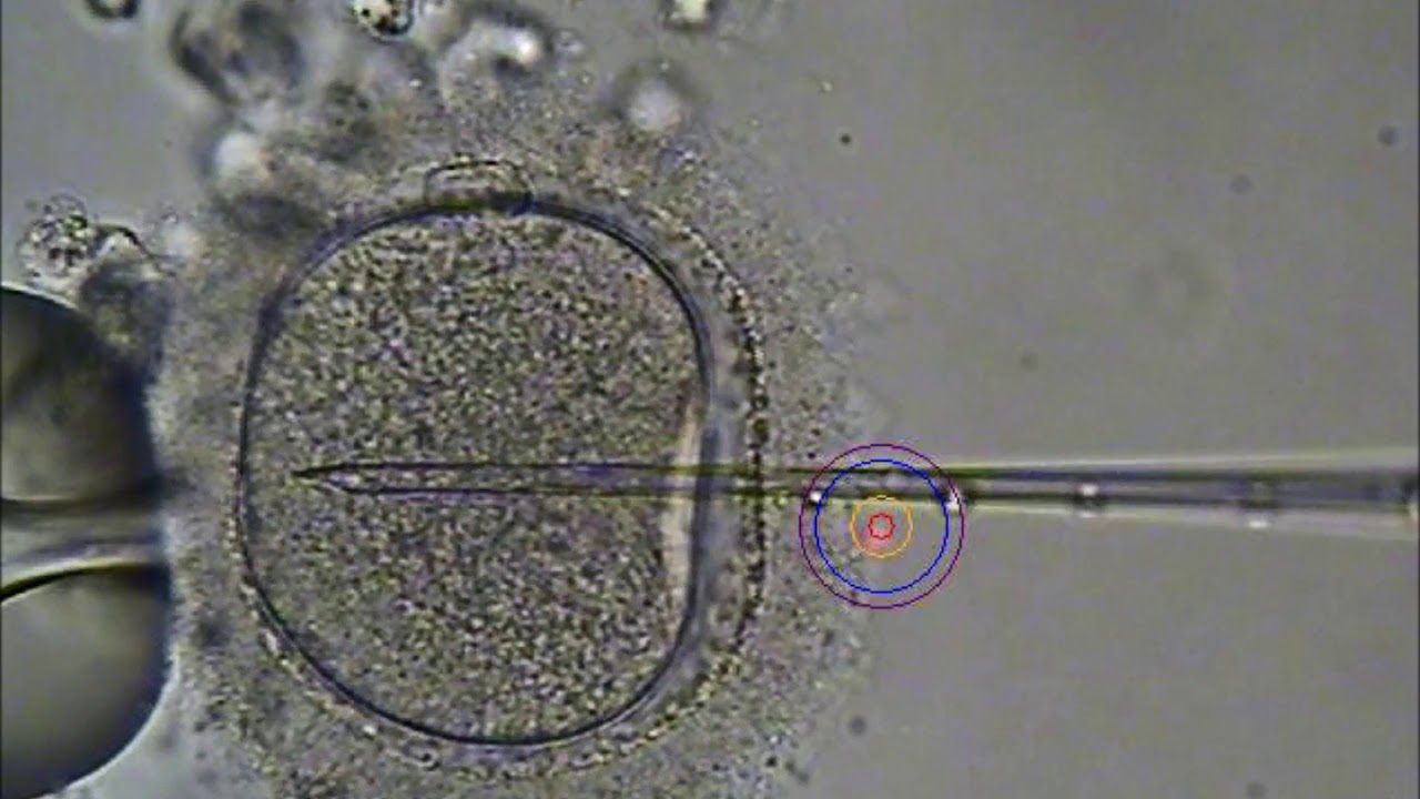 How to perform a Intracytoplasmic sperm injection - YouTube