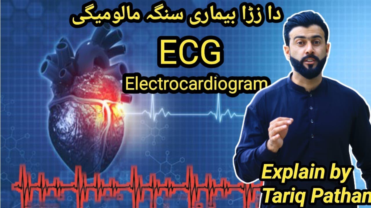 ECG explained by Tariq Pathan - YouTube