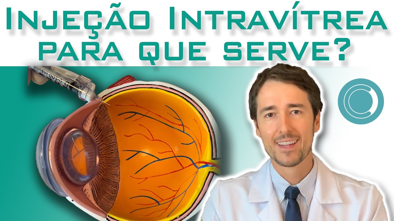 Injeção Intravítrea - para que serve ? - YouTube