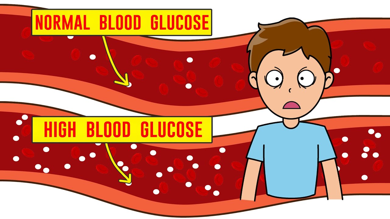 Lower Blood Sugar Level In 9 Simple Steps YouTube lower-blood-sugar-level-in-9-simple-steps-youtube