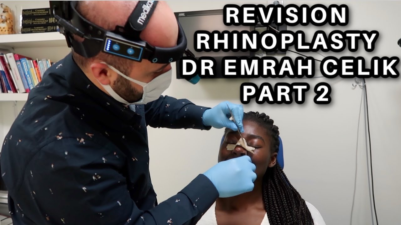 Revision Rhinoplasty Vlog | Dr. Emrah Celik | Part 2 | Jessica's Area ...
