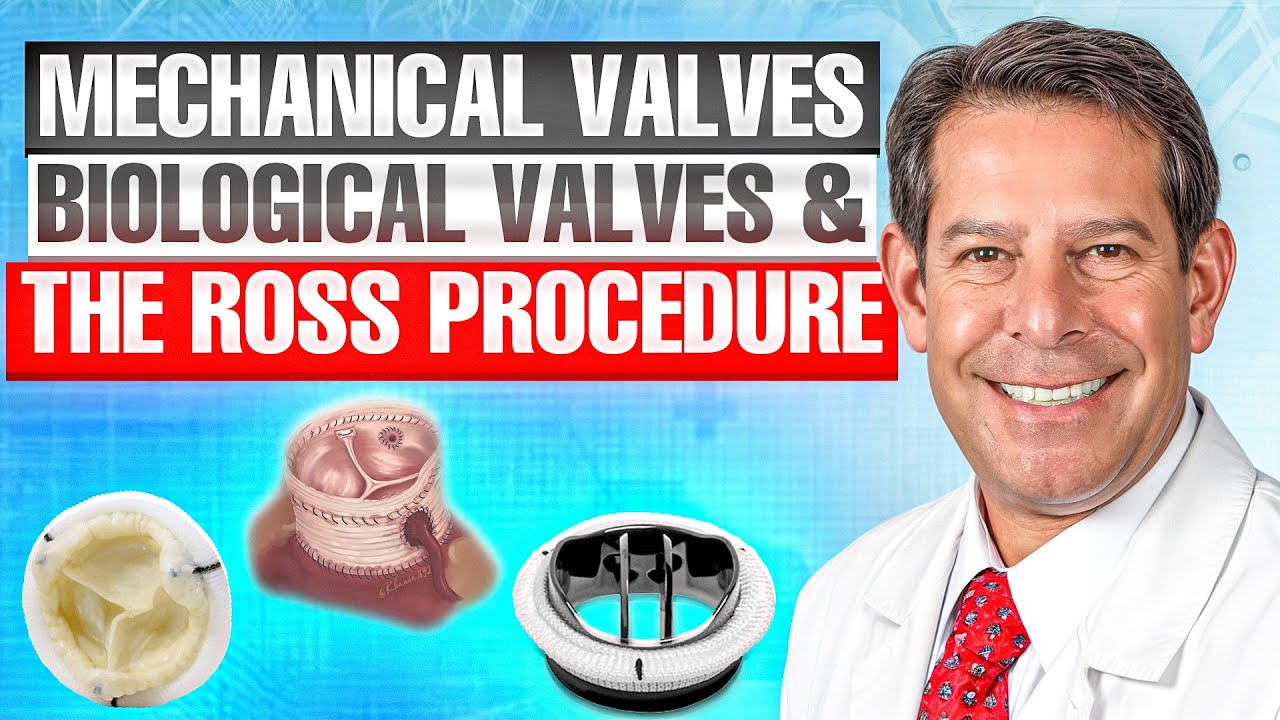 Evaluating Mechanical Valves, Biological Valves and the Ross Procedure ...