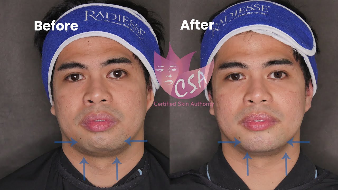 Square Chin For Men - YouTube