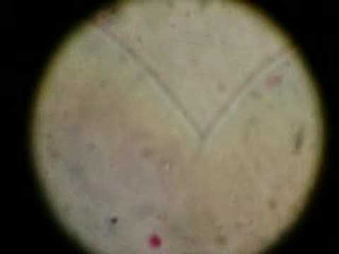 Cryptosporidium au microscope - YouTube