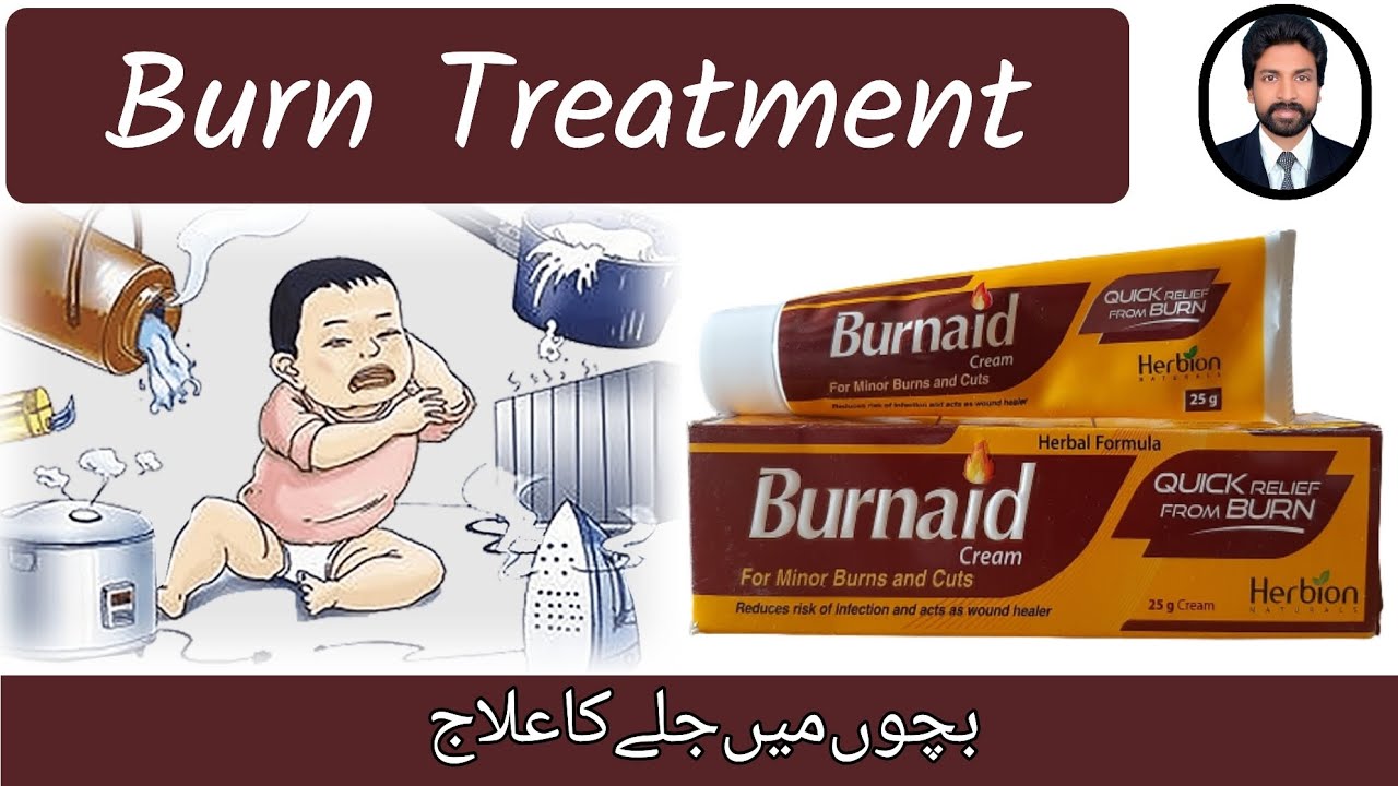 Burn Treatment In Child | Burnaid Cream Uses | Best Cream for baby skin ...