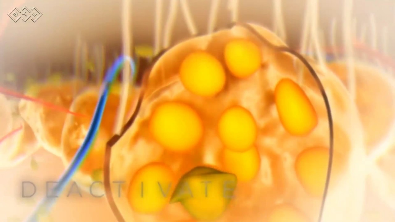 BTL Exilis Ultra VIDEO Patient education - YouTube