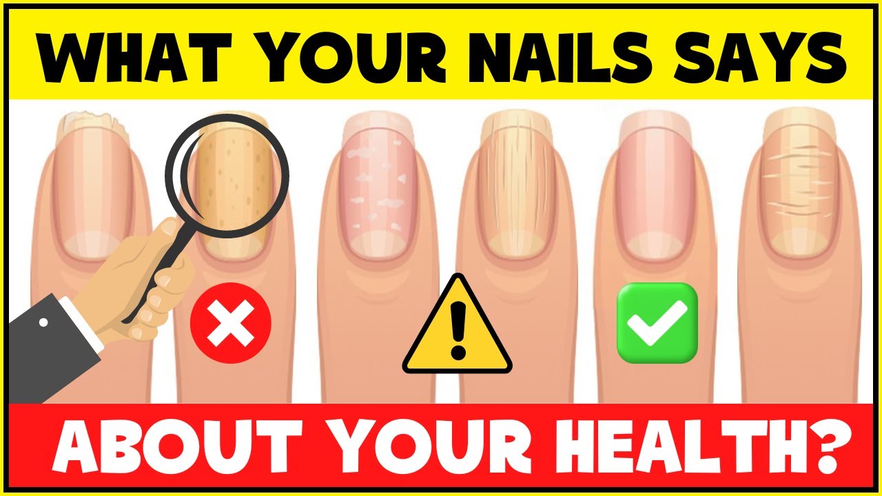 What Does The Color And Appearance Of Your Nails Say About Your Health ...