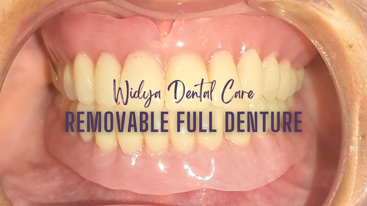 WDC_HOW REMOVABLE FULL DENTURES CAN IMPROVE THEIR SMILE AND THEIR ...