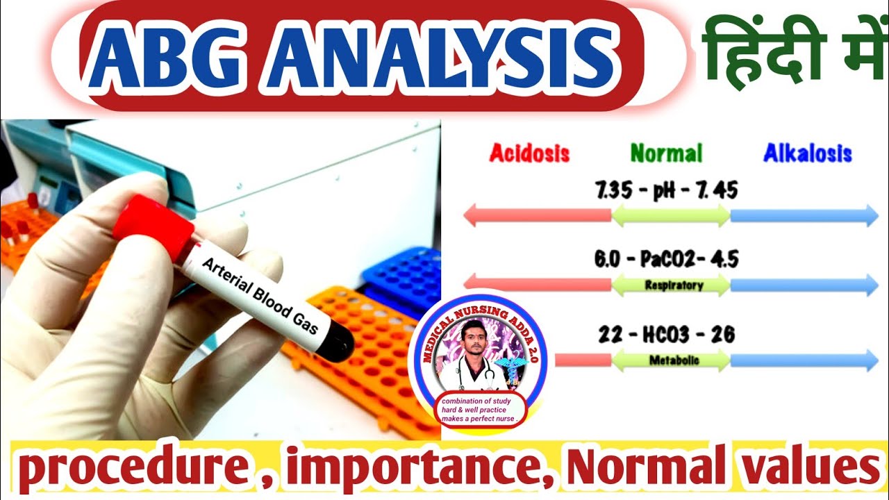 ABG analysis in hindi , ABG ANALYSIS procedure,uses // ABG procedure # ...