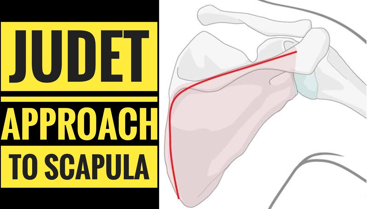 Judet Approach to Scapula and Plating - YouTube