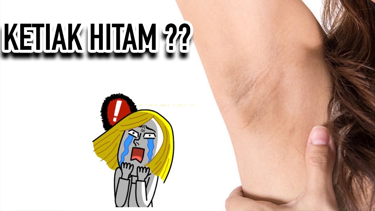 Punya Ketiak HITAM? 5 Bahan Alami Ini Bisa MEMUTIHKAN KETIAK - YouTube