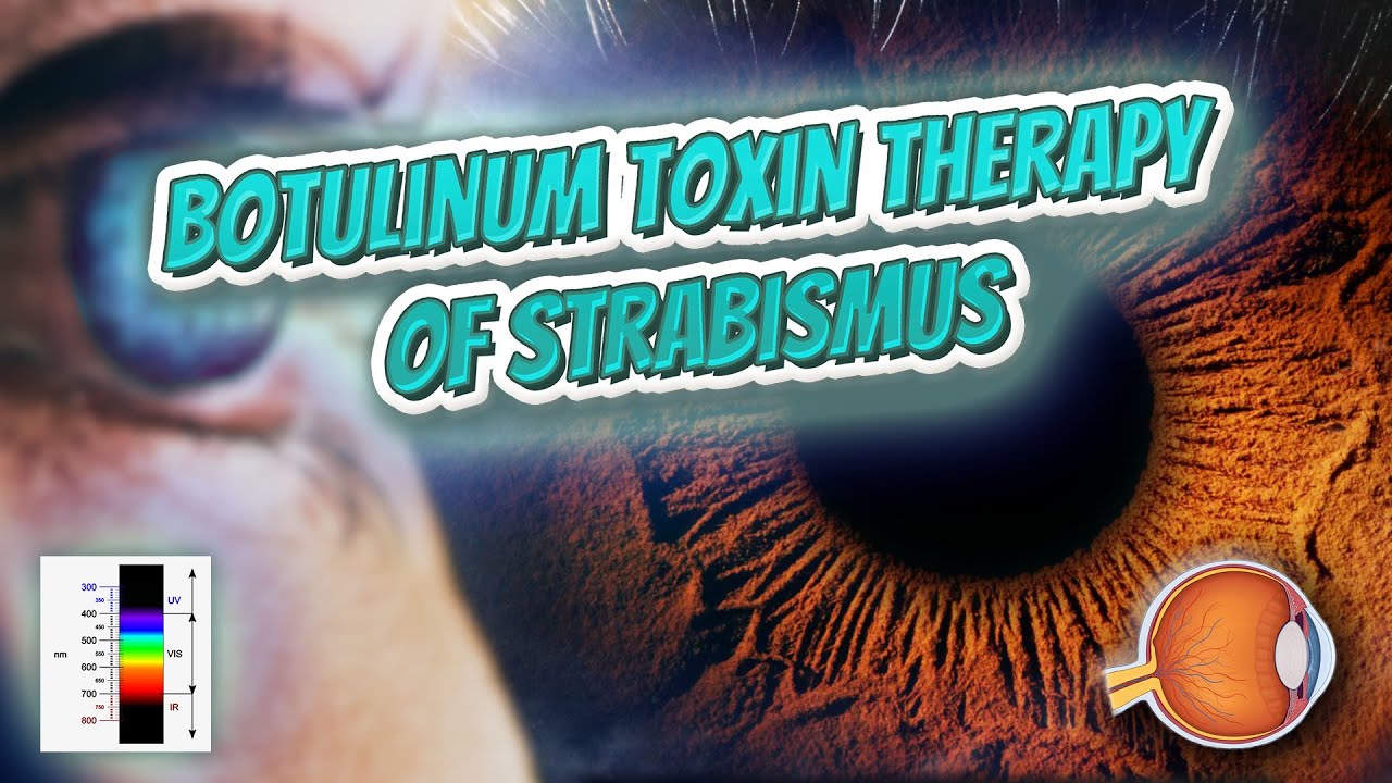 Botulinum toxin therapy of strabismus - Your EYEBALLS - EYNTK 👁️💉😳💊🔊💯 ...