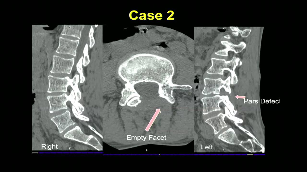 Tim Yoon MD - YouTube