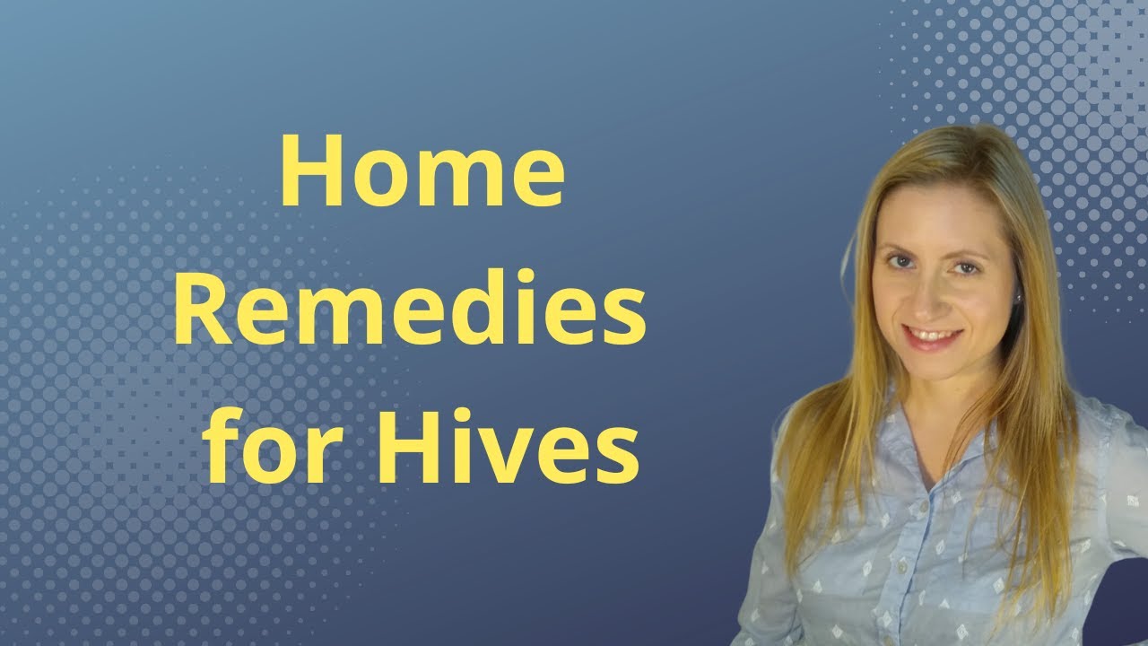 Natural Home Remedies for Hives - YouTube