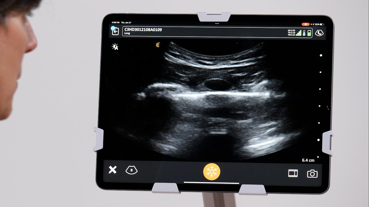 Image Smoothing - YouTube