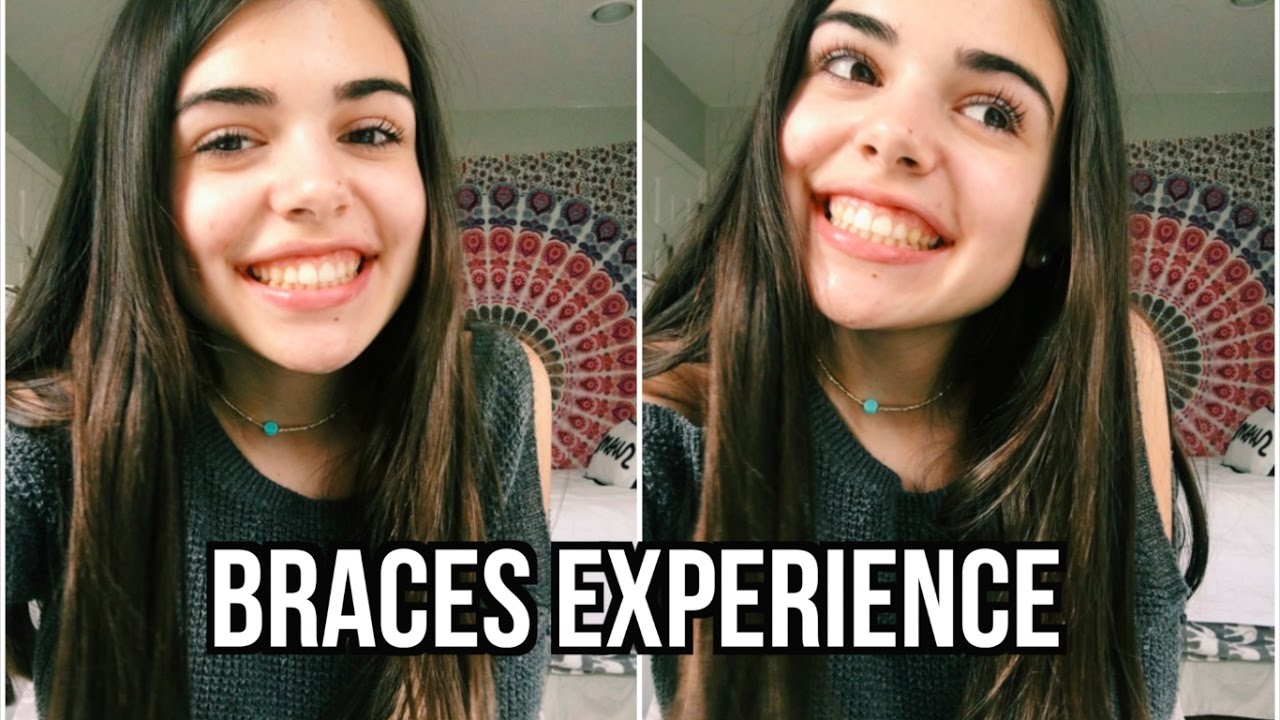FULL BRACES EXPERIENCE | Before & After! - YouTube