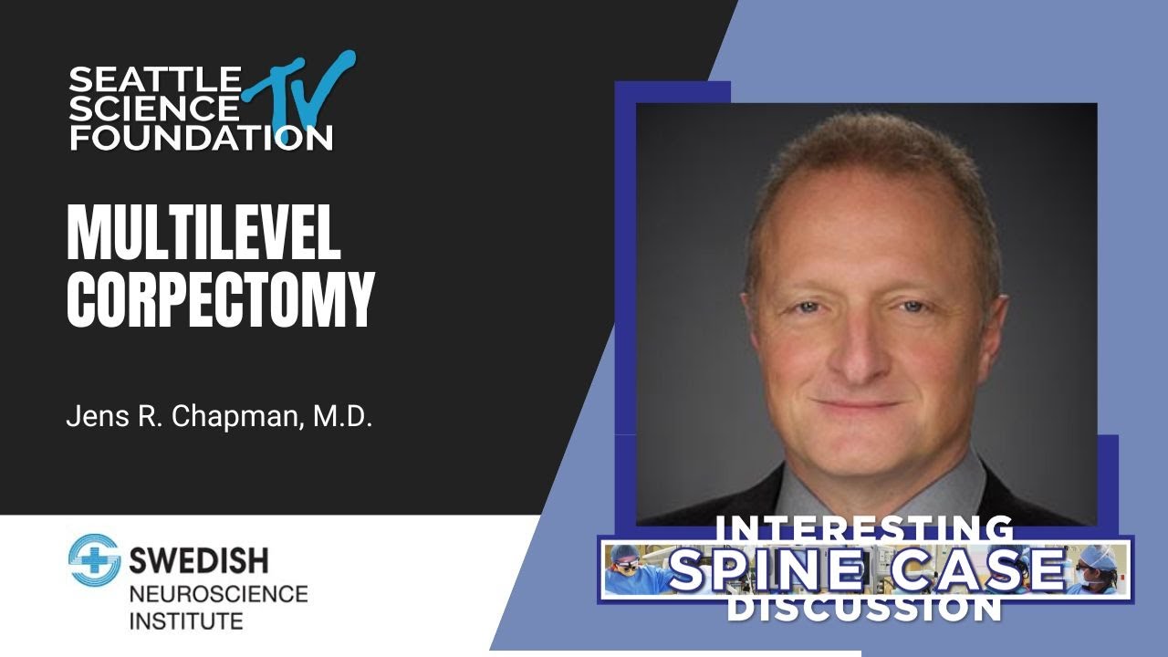 Multilevel Corpectomy – Jens R. Chapman, MD - YouTube