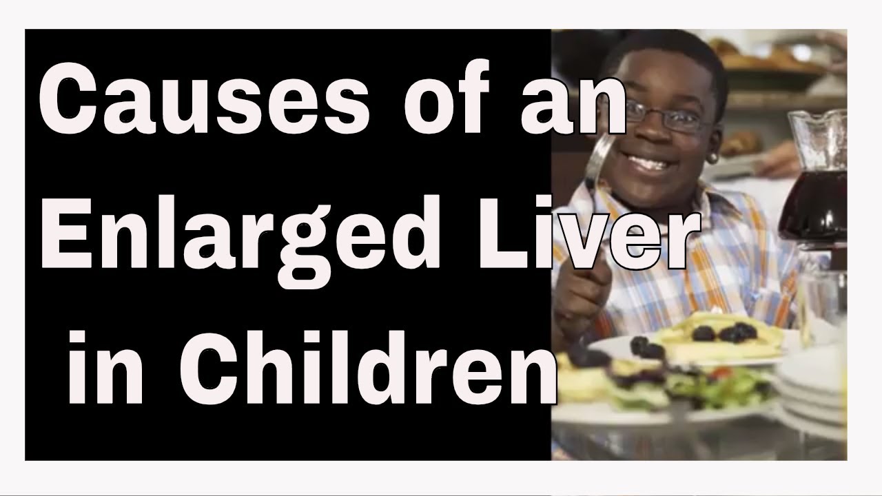 What Are the Causes of an Enlarged Liver in Children - YouTube