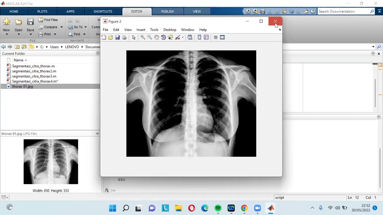 Segmentasi Citra Menggunakan Metode Active Contour - YouTube