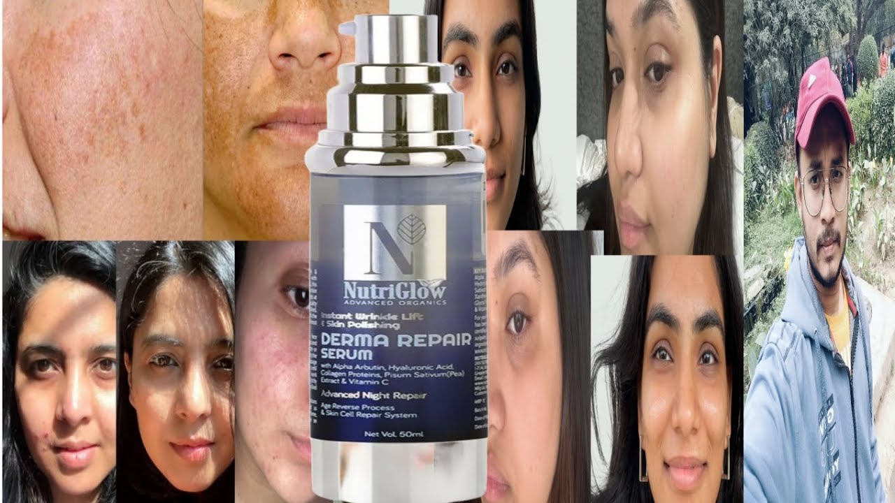 Nutriglow Derma Repair Serum | Honest Review - YouTube