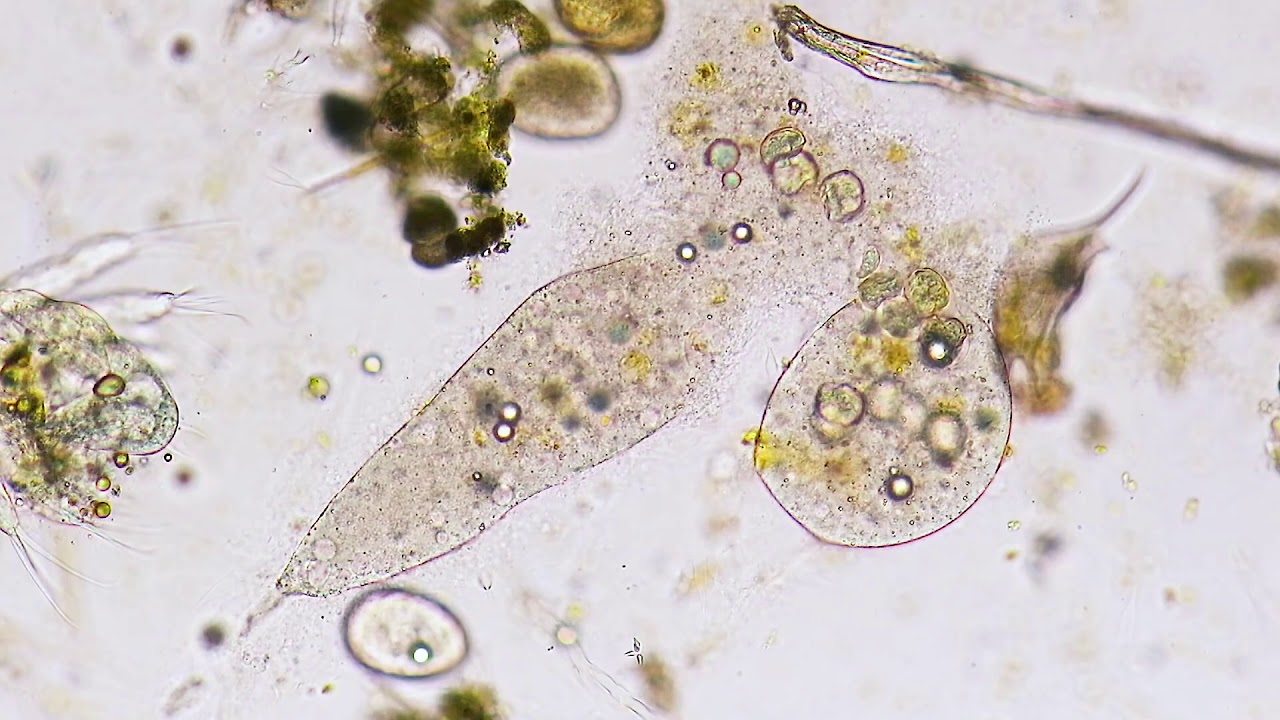 Microbiology 101: Microscopy (Lecture 2 of 12) - YouTube