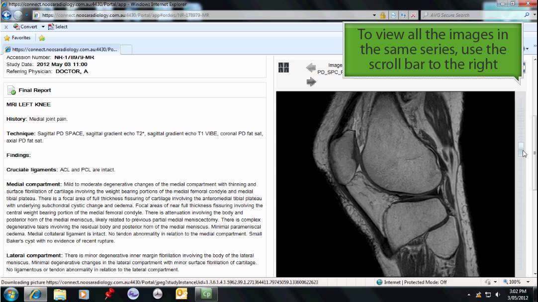 Noosa Radiology Connect 'How To' Demonstration.mp4 - YouTube