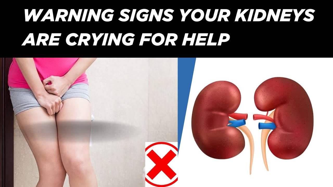 10 Kidney Warning Signs You Should Never Ignore - YouTube