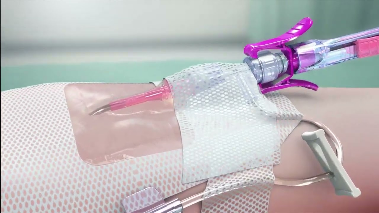 BD PIVO Needle-free blood collection device: user Instructions - YouTube