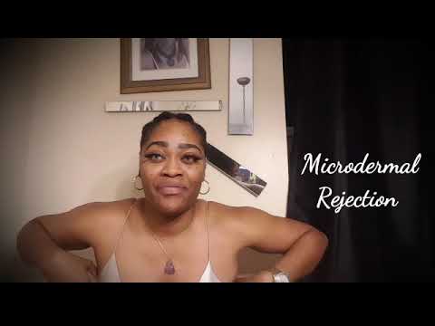MicroDermal Rejection - YouTube