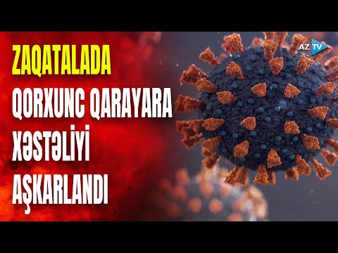 Zaqatalada 3 sakində qarayara xəstəliyi aşkarlandı: qurumlar hərəkət keçdi