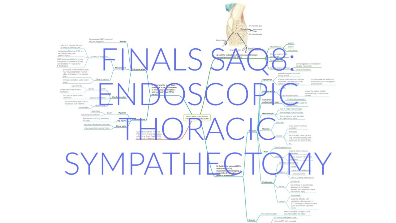 FINALS ANAES SAQ8: ENDOSCOPIC THORACIC SYMPATHECTOMY - YouTube