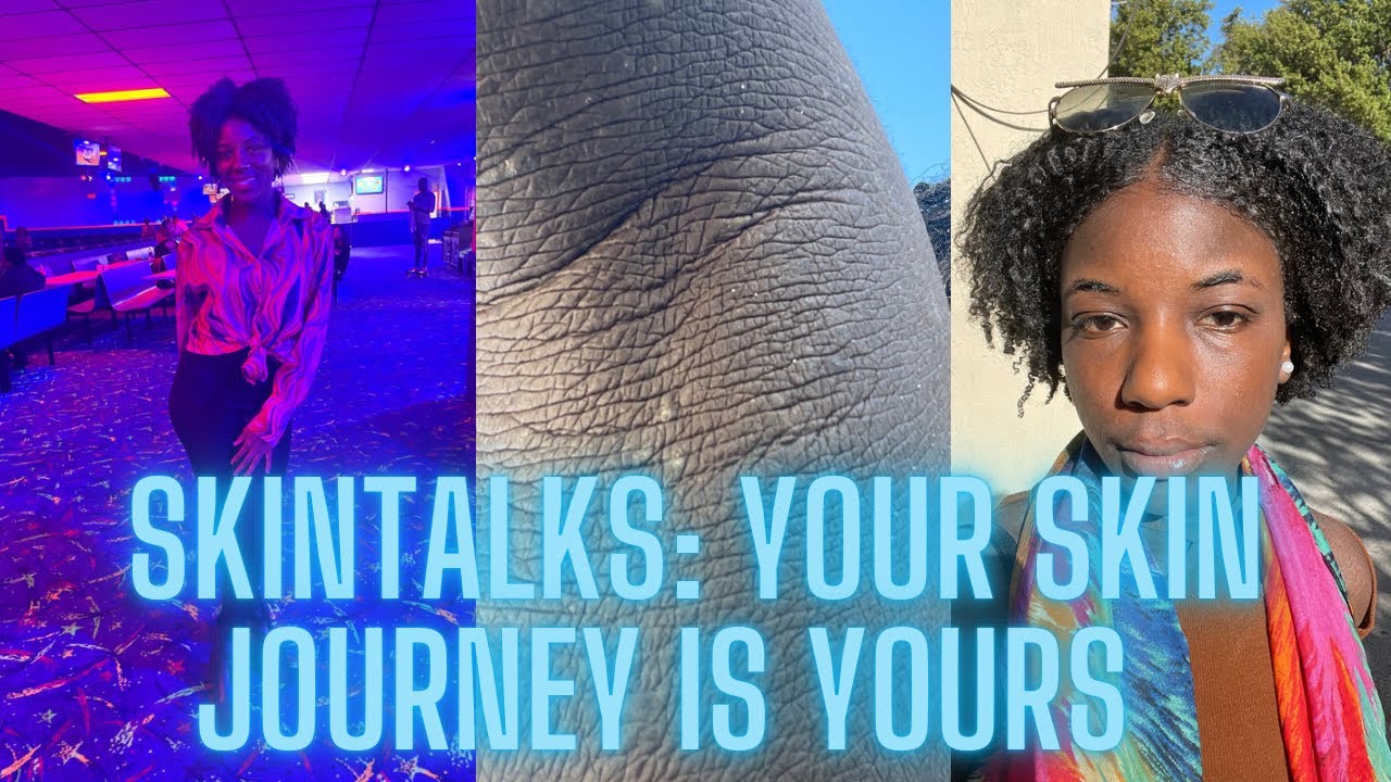 Skin Talks: Your ECZEMA/TSW JOURNEY is YOURS!! - YouTube