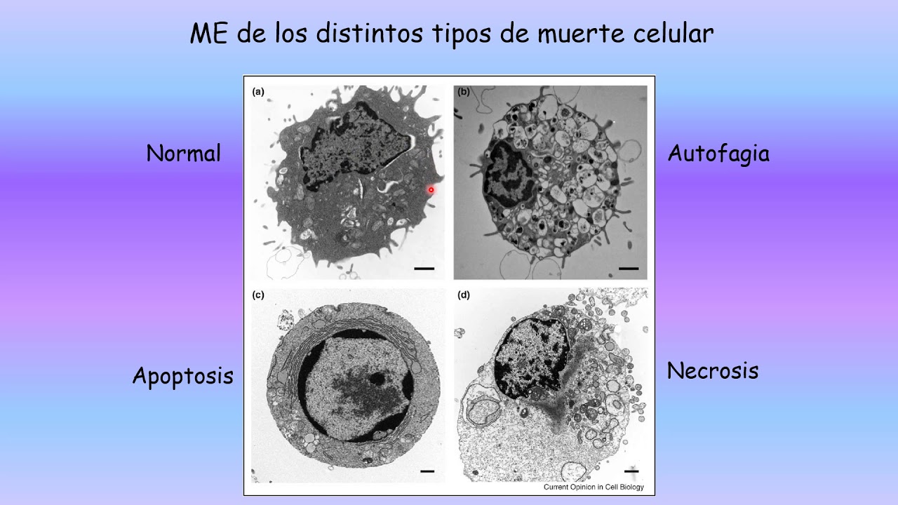 Clase 10 Muerte celular - YouTube