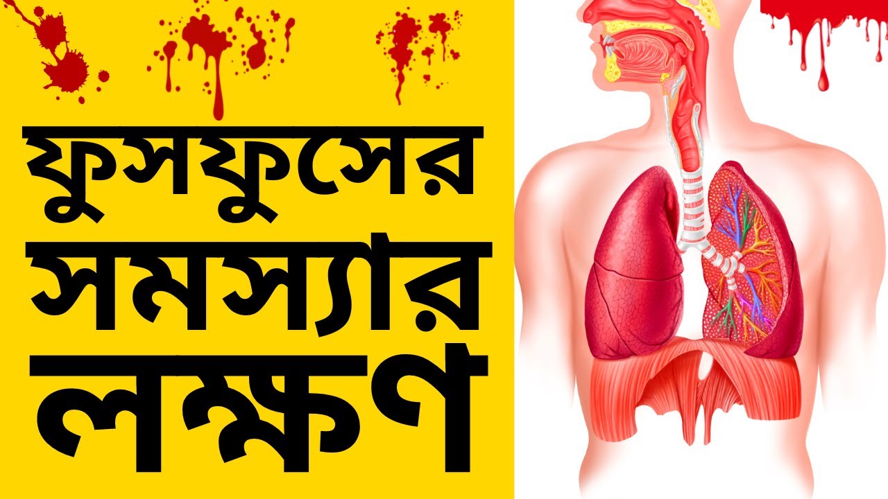 লাঞ্চে ইনফেকশন | ফুসফুসের সমস্যার লক্ষণ | লাঞ্চে পানি জমলে করণীয় ...