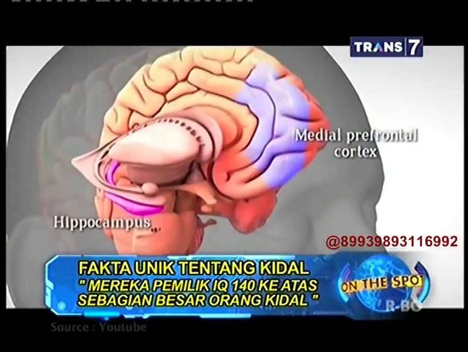 On The Spot Fakta Unik Tentang Kidal - YouTube
