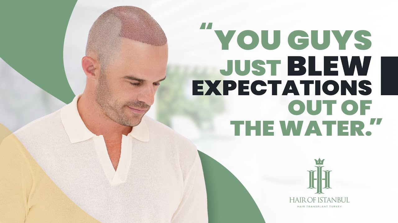 Jeff Trembley's Hair Restoration Journey with Hair of Istanbul - YouTube