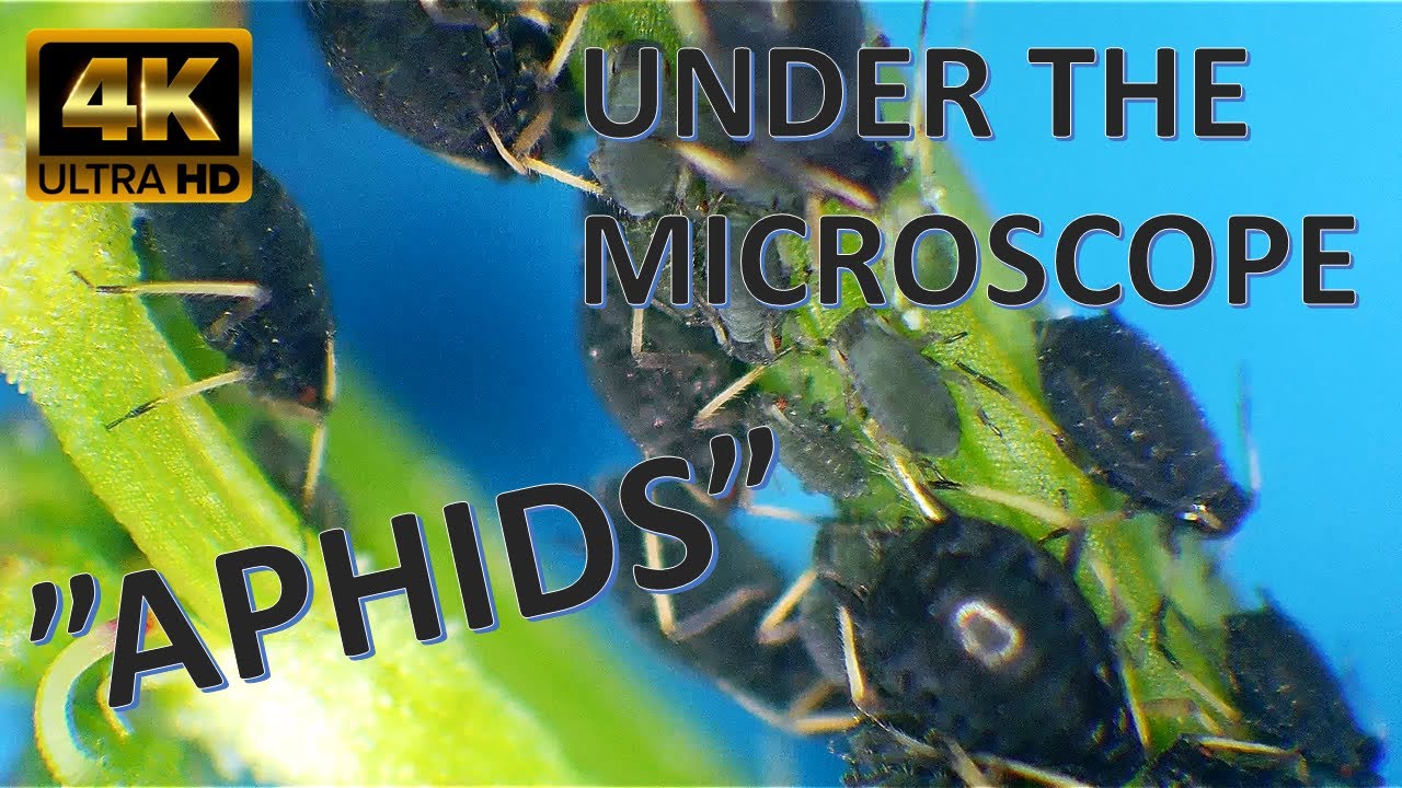 APHIDS - Under the microscope ("The mission" EP. 02) - YouTube