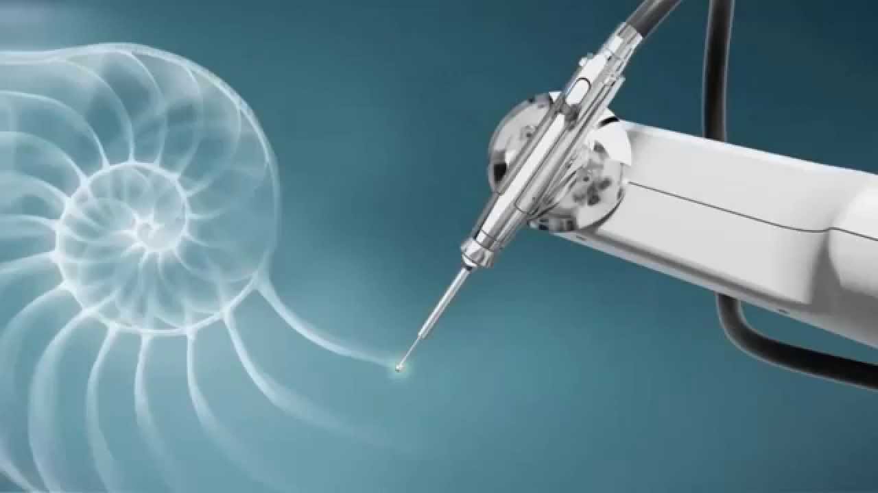 MAKO Animation - Knee - YouTube