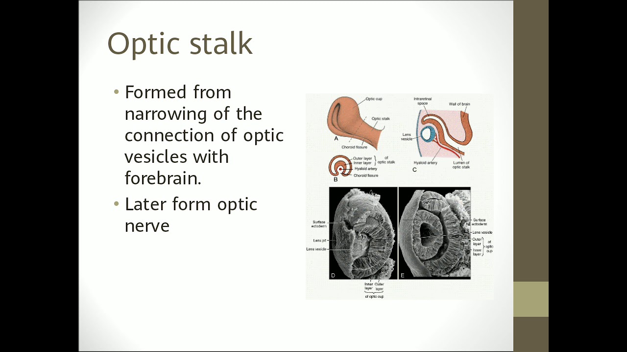 Development of eye (slideshare), embryology, 2nd year guide - YouTube
