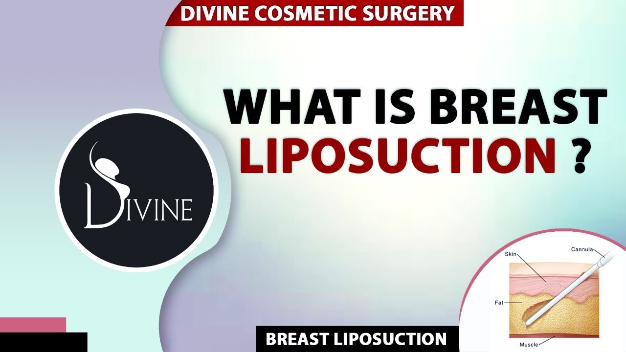 What is Breast Liposuction? | Plastic Surgery India - YouTube