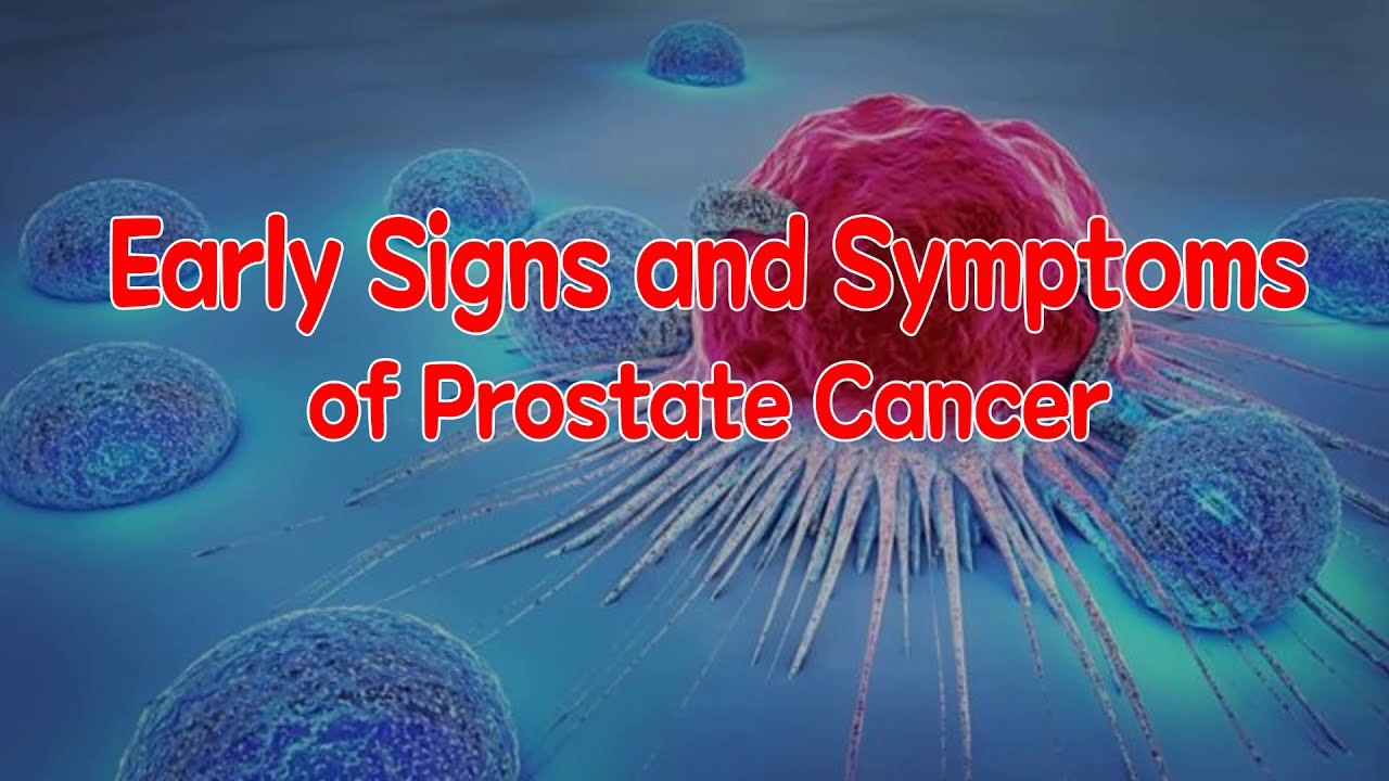 Prostate cancer Warning Signs and Symptoms early stages - YouTube