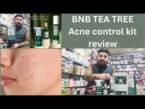bnb tea tree acne control kit review ||BNB acne control kit||best acne ...