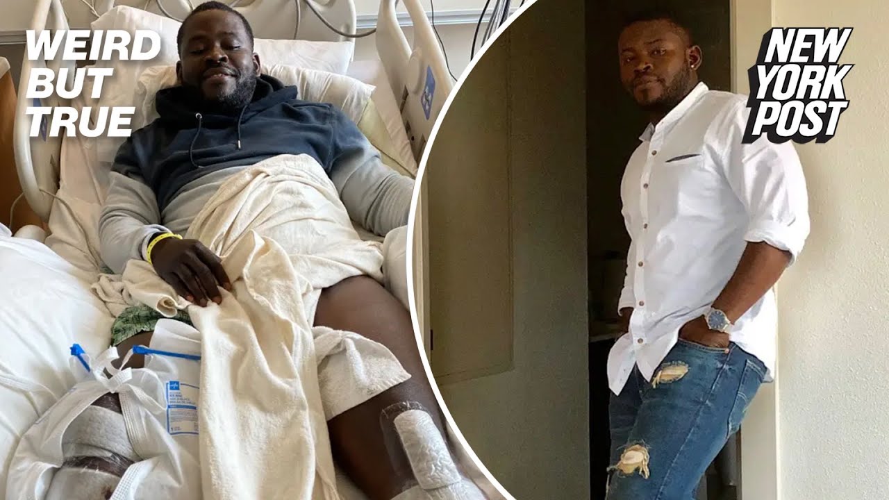 Leg lengthening surgery, AI catfish, and real-life Snoopy | Weird But ...