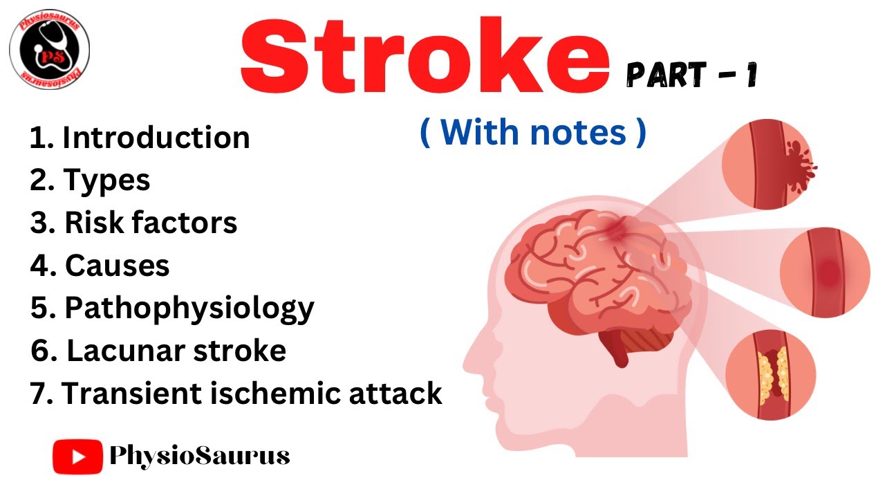 Stroke | Types | Causes | Risk factors | Pathophysiology | Lacunar and ...