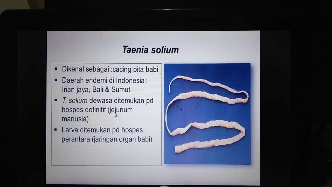 Cestoda (cacing pita babi) - YouTube