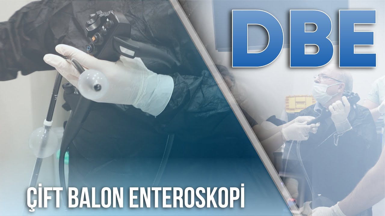 Çift Balon Enteroskopi Nedir ? | DBE | Double Balloon Enteroscopy ...