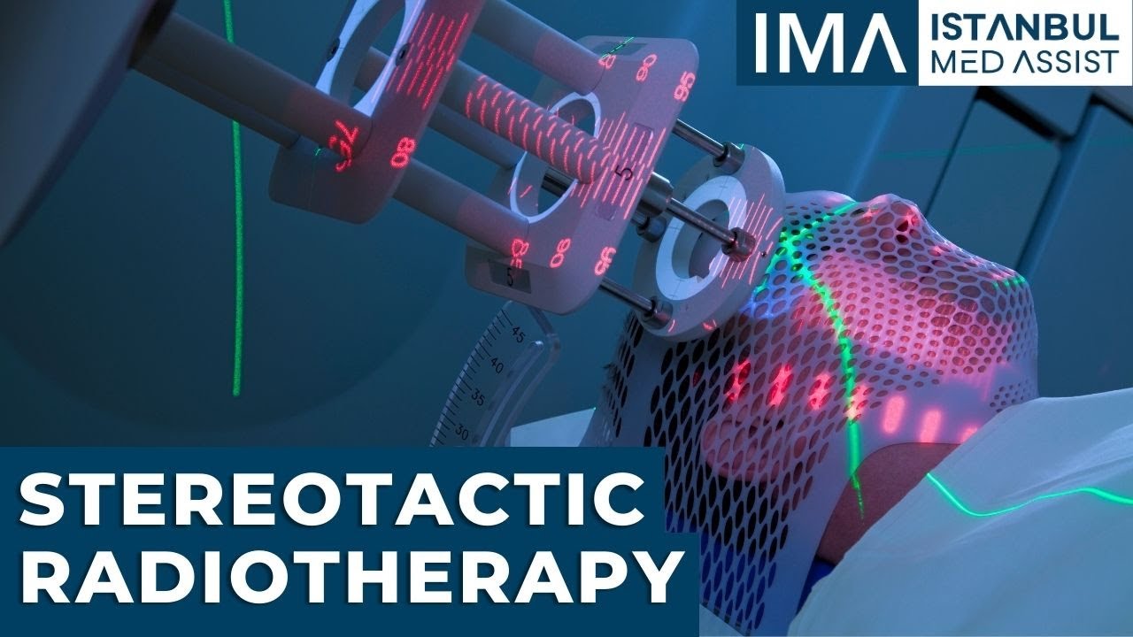 Stereotactic Radiotherapy (SRT) - Istanbul Med Assist - YouTube