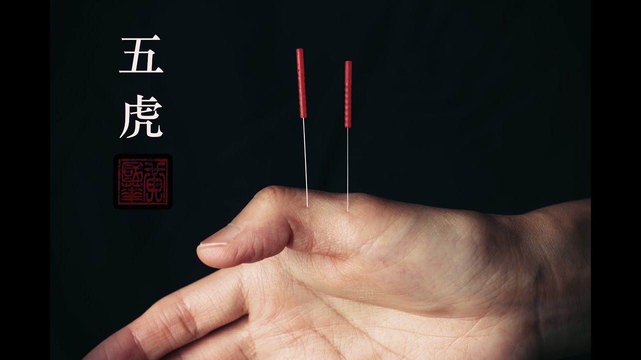 Instant Finger Pain Relief Acupuncture - YouTube