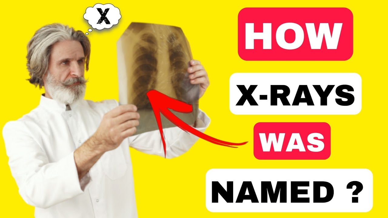 How X Rays Named | Discovery of X Rays | Doctor Inside Academy - YouTube