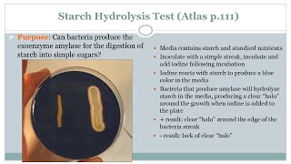 Starch Hydrolysis Test Lipid Hydrolysis Test (Lipase Test) Principle,